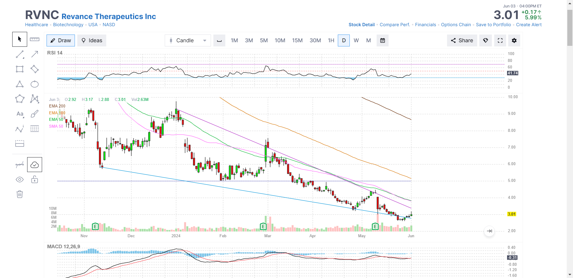 EZPZ Trading LLC - Stocks and Options Trading